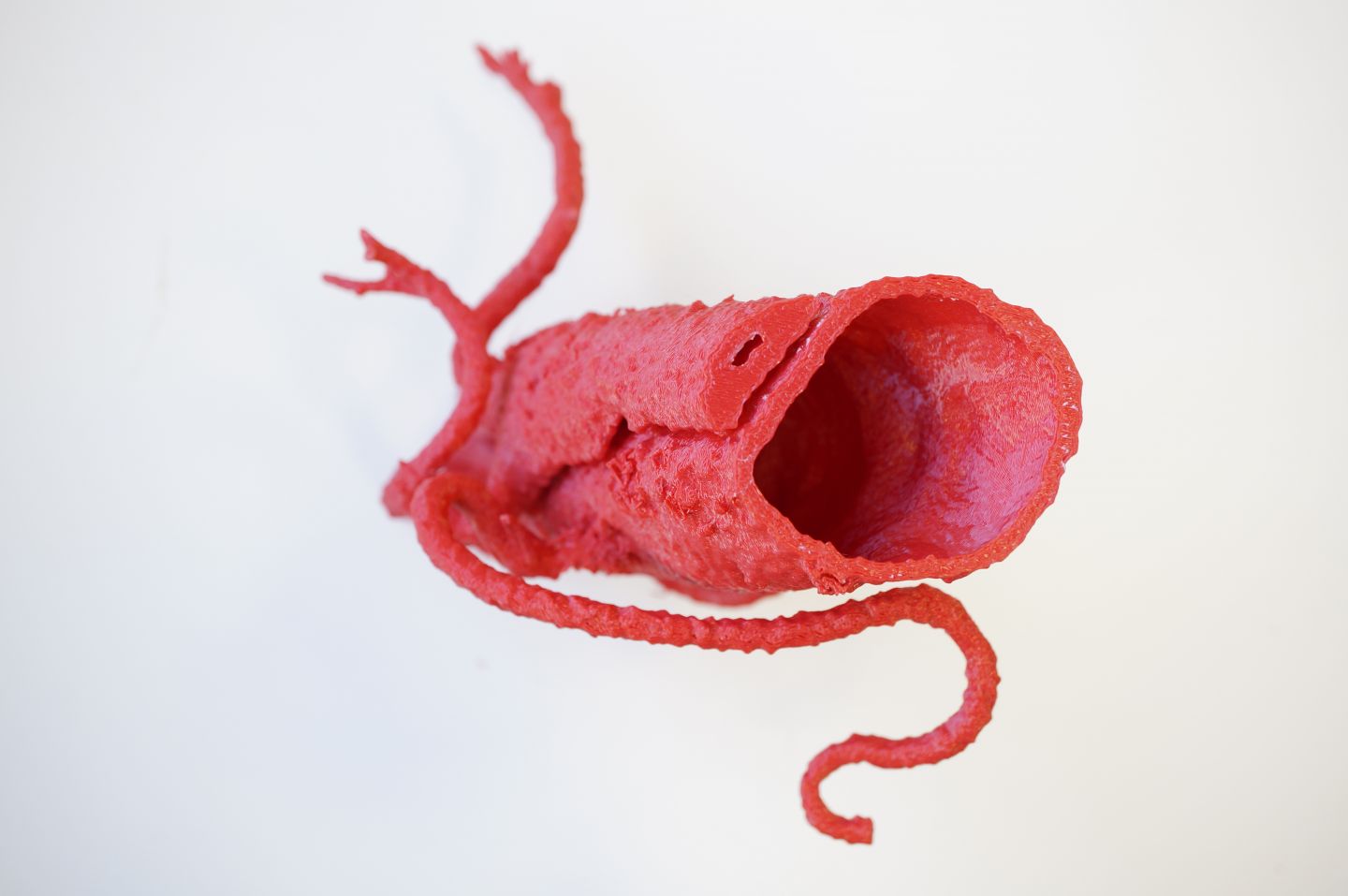 Five ways 3D printing is changing medicine | Pursuit by the University ...