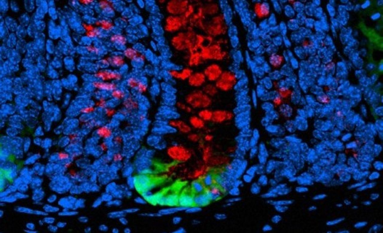 Targeting dormant cancer cells | Pursuit by the University of Melbourne