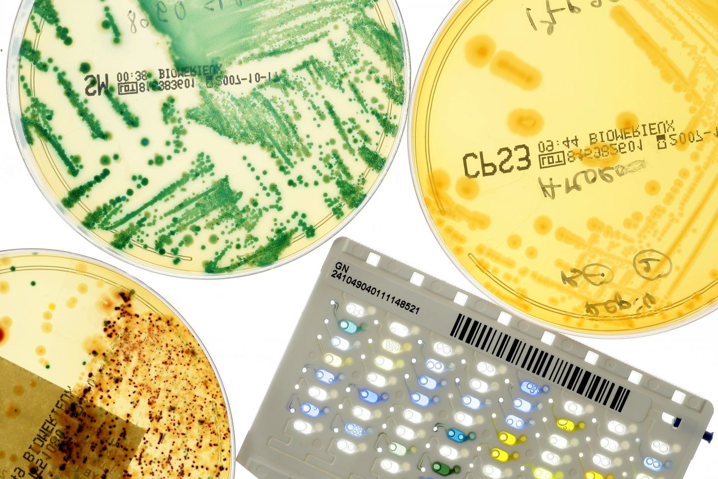 Into the wild to fight antibiotic resistance | Pursuit by the ...