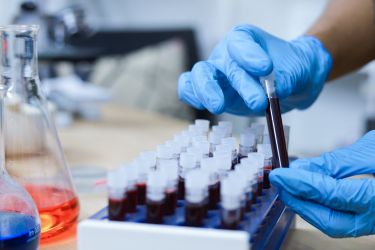How your blood can help understand COVID-19 vaccine responses | Pursuit ...