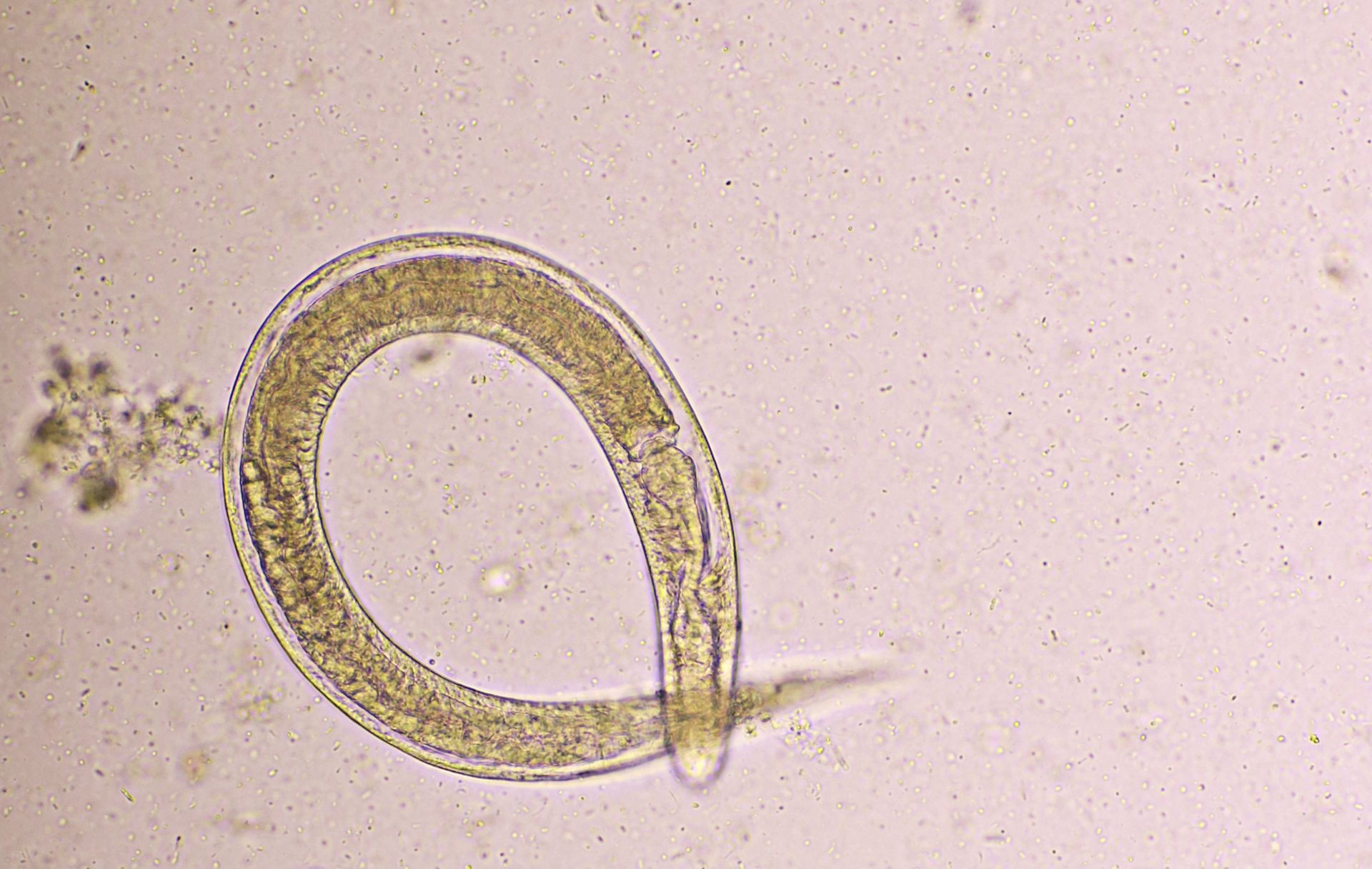 Parasites may be gross, but so is Australia’s attitude to Indigenous ...